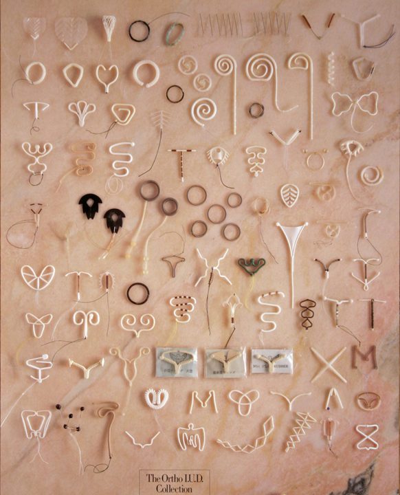 The troubled history of the IUD | adyn